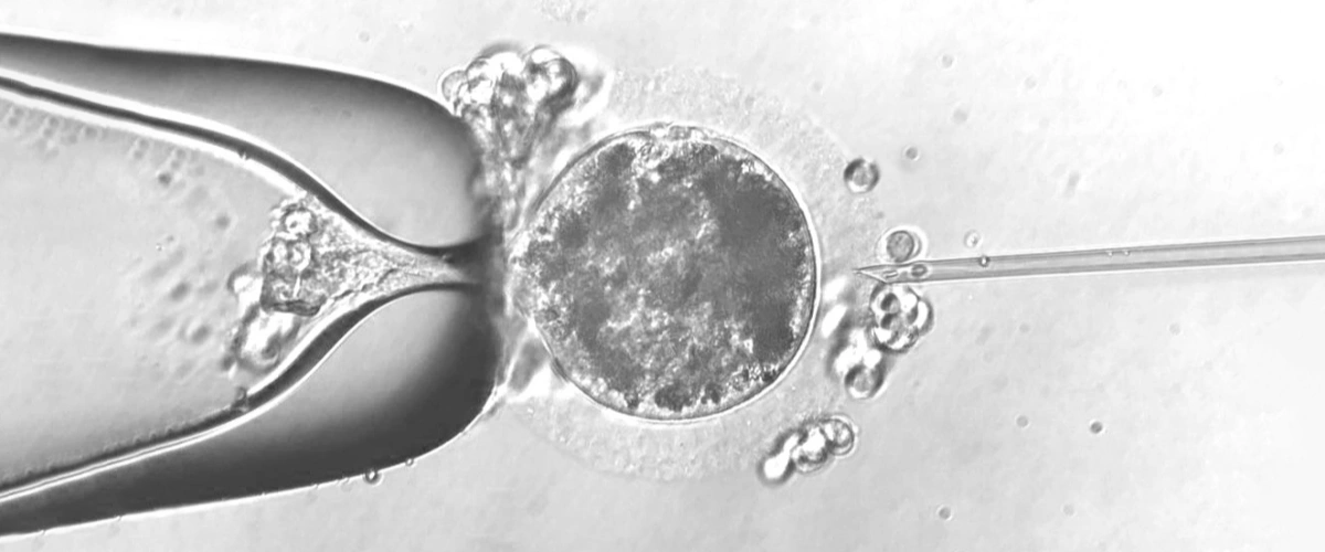 Seguimiento de la gestación de embriones de ICSI en yeguas